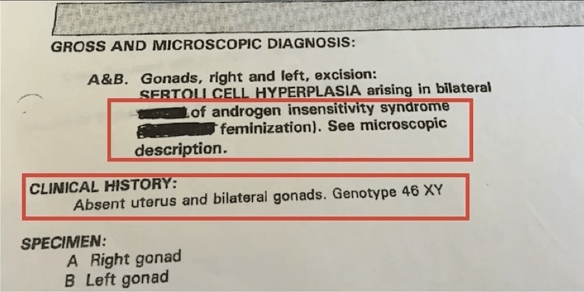 Video: Esta niña tiene pelotas. Por Georgiann Davis – Brújula Intersexual